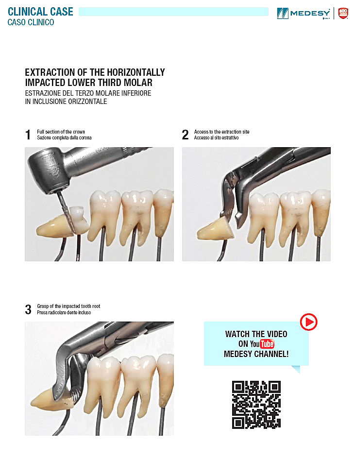 Tooth Forceps by Dr. Comella 2400/70 - Dentistree Online Shop